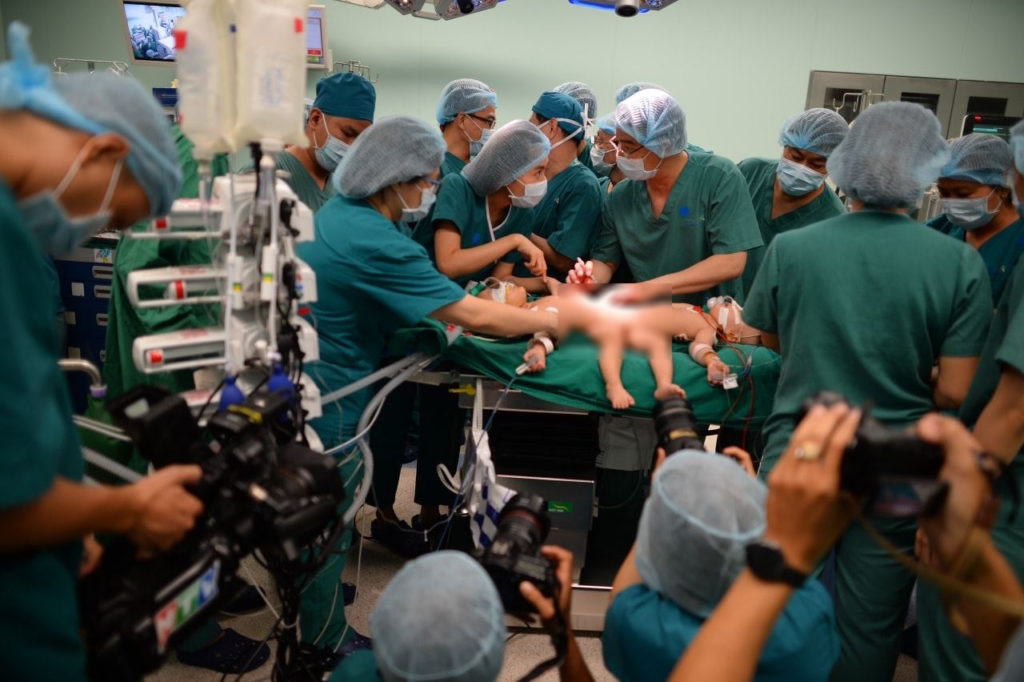 Vietnamese Doctors Perform Surgery To Separate Conjoined Twins