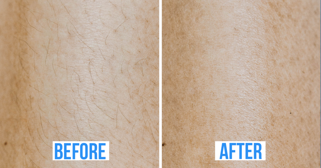 Japan IPL Express Is Now Giving Out Free 100 IPL Shots If You're Tired ...