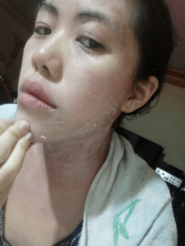 5 Women Share The Stories Behind Their Scars & How They Have Made Them ...