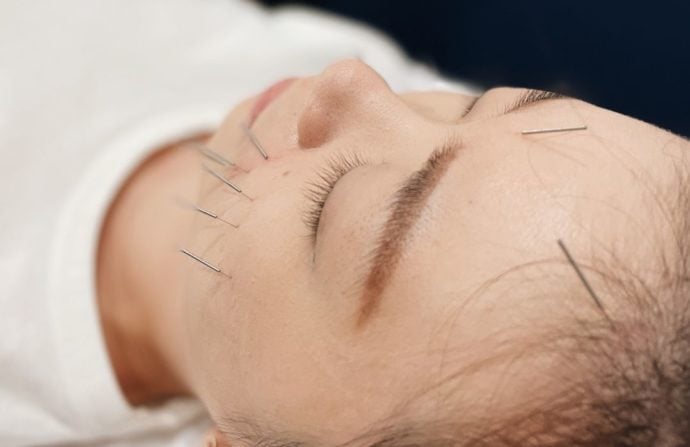 13 Best TCM Clinics In Singapore To Get Your Aches & Pain Sorted