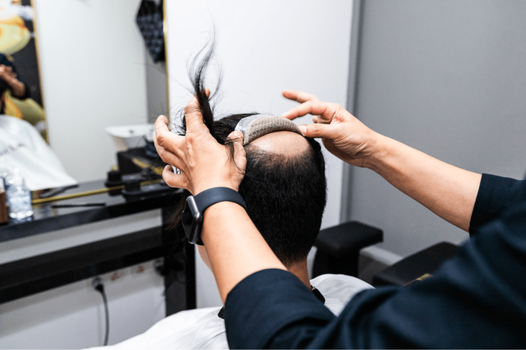 5 Ways To Deal With Hair Loss If You Are Starting To Shed In Your 20s