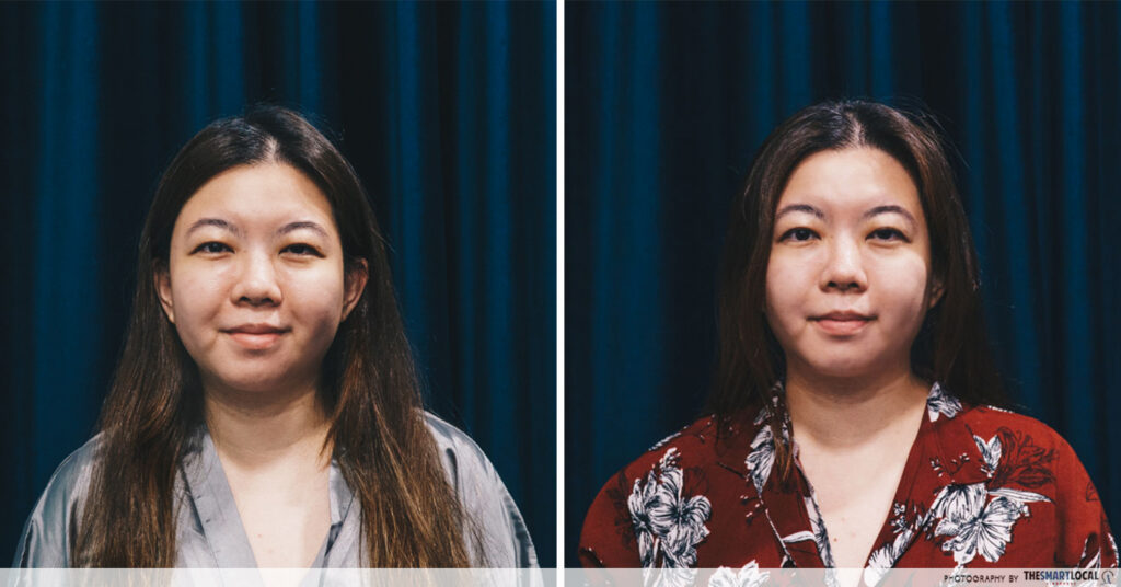 MODE Aesthetics: Intralift Oral Facelift Review